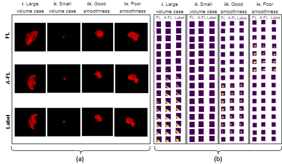 Enhancing Semantic Segmentation with Adaptive Focal Loss | BioRAIN Lab